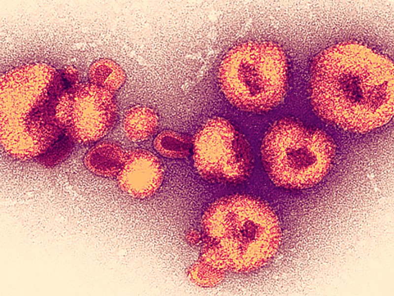 ProMED: Lassa fever monitoring across Africa and Europe after death of ...