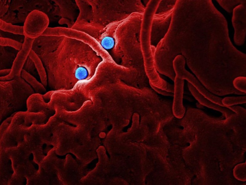 ProMED: 4 more cases of MERS reported in Saudi Arabia | CEPI